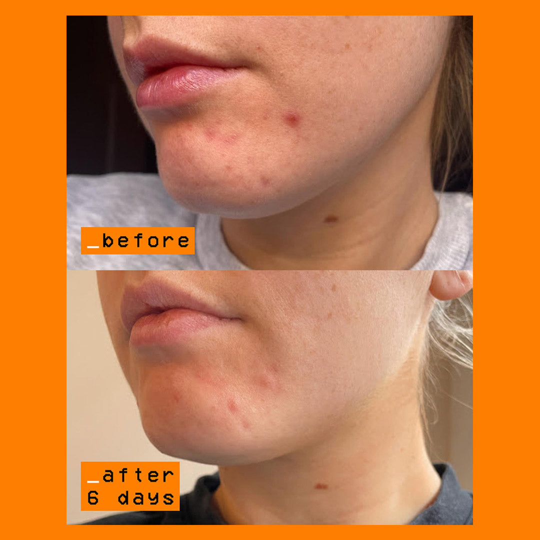 Glow Hub - Scar Slayer Wand – BPerfect Cosmetics